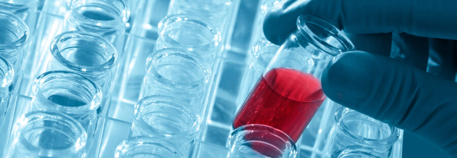 Research News and Priorities - amfAR, The Foundation for AIDS Research